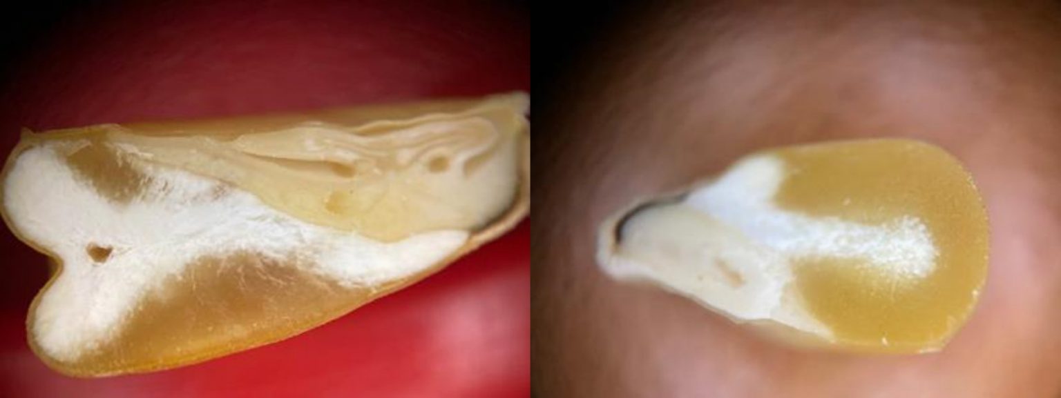 Microestructura de Granos: Maíz – Innograin